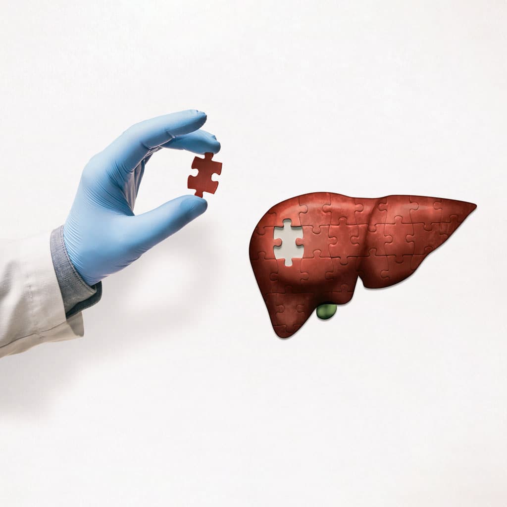 Micro CRISPR | Bilakhia Holdings