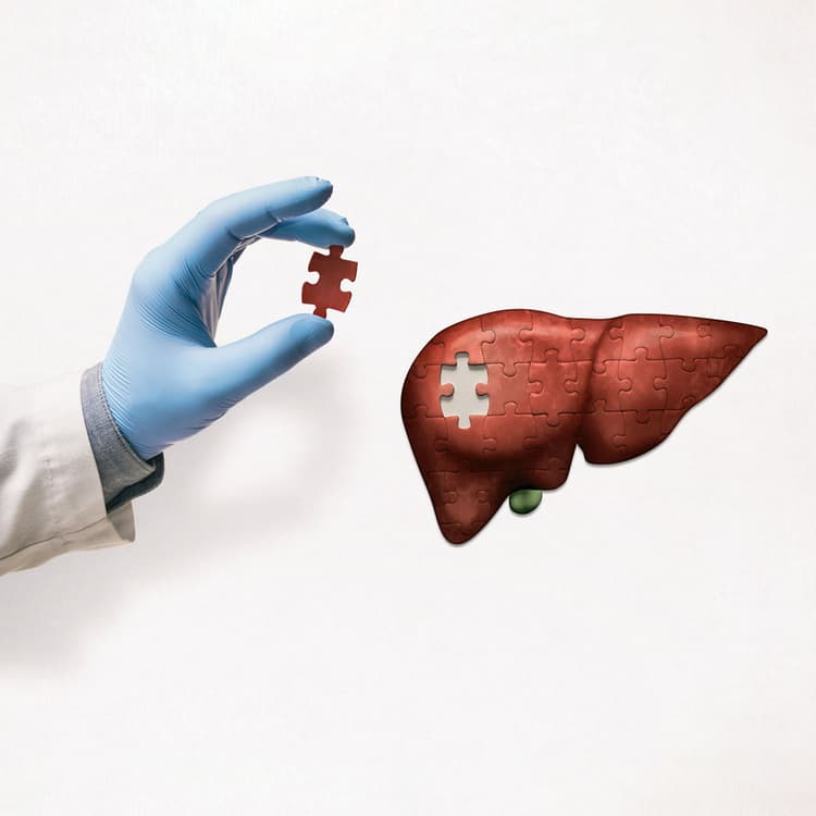 Micro CRISPR | Bilakhia Holdings